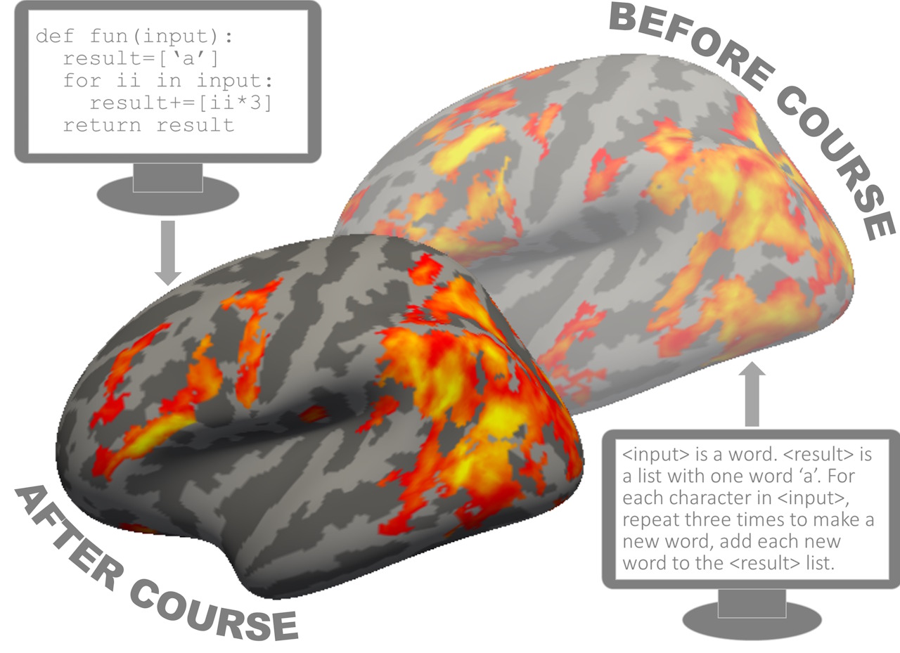 Мозок кожної людини виявився здатним навчитися програмувати - nauka.ua — Новини науки ...